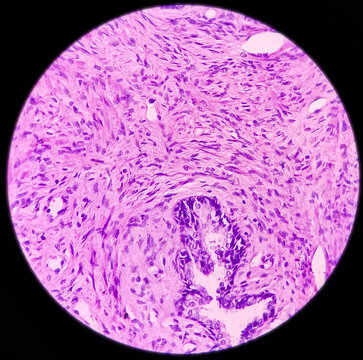 Turp 画像 - 参照 384 Stock 写真、ベクターおよびビデオ | Adobe Stock