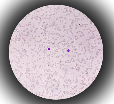 รูปภาพSpherocyte – เลือกดูภาพถ่ายสต็อก เวกเตอร์ และวิดีโอ291 | Adobe Stock