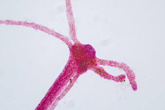 Hydra Under Microscope