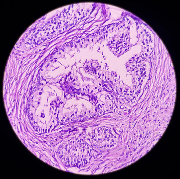 Turp 画像 - 参照 384 Stock 写真、ベクターおよびビデオ | Adobe Stock