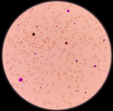 รูปภาพNrbc – เลือกดูภาพถ่ายสต็อก เวกเตอร์ และวิดีโอ73 | Adobe Stock