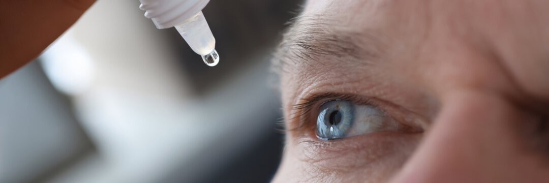 Blefarit bilder – Bläddra bland 1,184 stockfoton, vektorer och videor ...