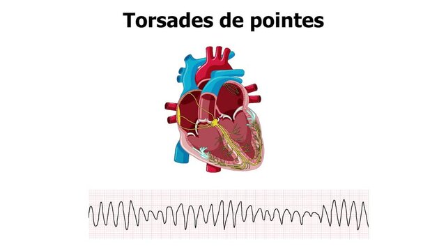 Pointes Billeder – Gennemse 8,281 stockfotos, vektorer og videoer ...