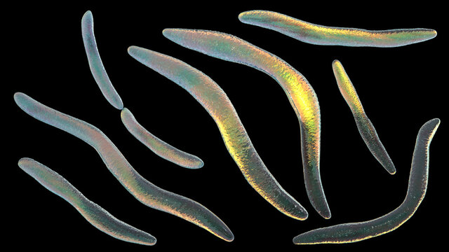 DIE 50 BESTEN BILDER, STOCK-FOTOS UND -VEKTORGRAFIKEN ZU „Pestsepsis ...