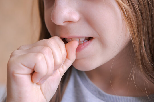 รูปภาพDermatophagia – เลือกดูภาพถ่ายสต็อก เวกเตอร์ และวิดีโอ227 | Adobe ...