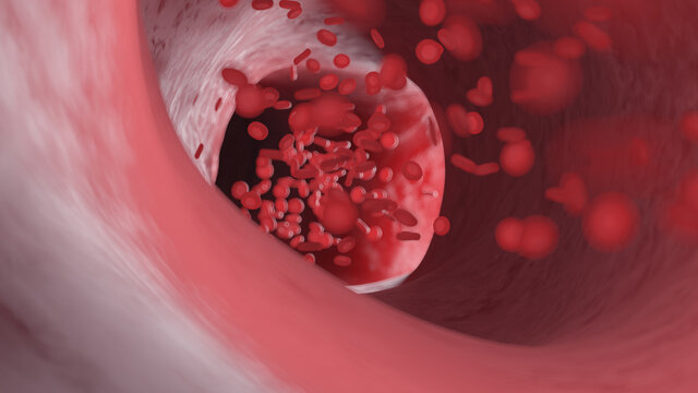 รูปภาพBloodstream – เลือกดูภาพถ่ายสต็อก เวกเตอร์ และวิดีโอ26,903 ...