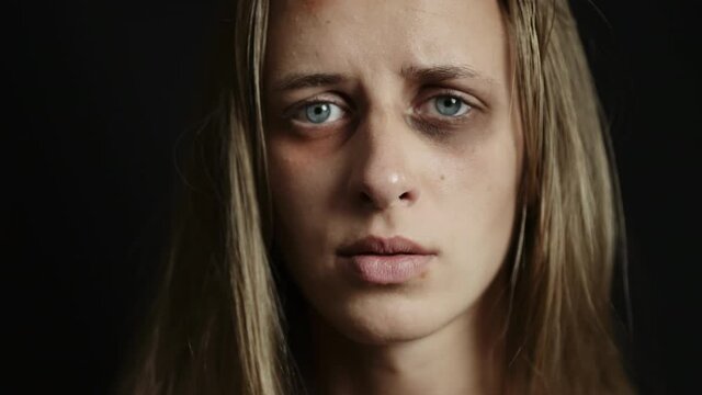 Beat Up Face Images – Browse 21,652 Stock Photos, Vectors, and Video ...