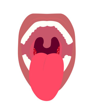 Gaumenmandeln Bilder – Durchsuchen 329 Archivfotos, Vektorgrafiken und ...