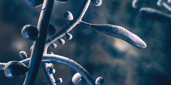 Dermatomycosis bilder – Bläddra bland 6,898 stockfoton, vektorer och ...