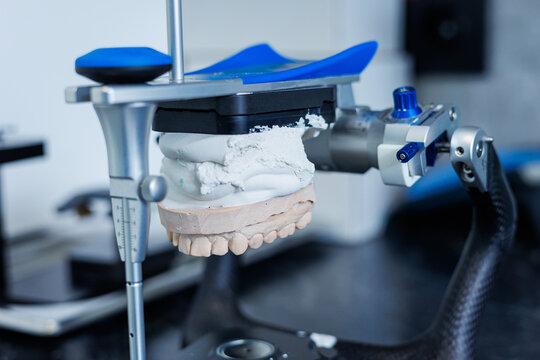 Orthodontal bilder – Bläddra bland 1,467 stockfoton, vektorer och ...