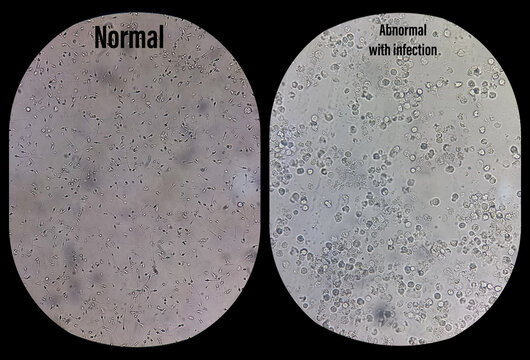 "Healthy Sperm" Images – Browse 18 Stock Photos, Vectors, and Video ...