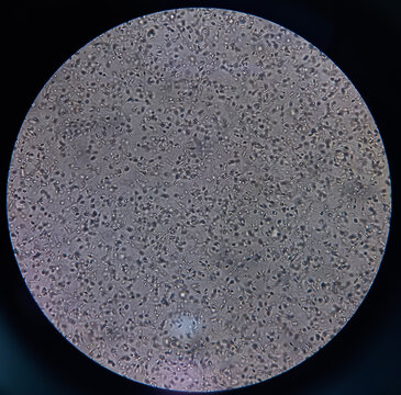 Azoospermia Images – Browse 210 Stock Photos, Vectors, and Video ...