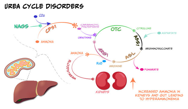 Urea Cycle Disorder