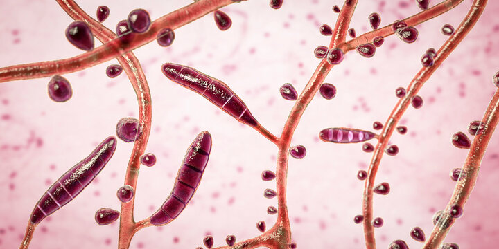 「Dermatomycosis」の画像 - 7,107 件の Stock 写真、ベクターおよびビデオ | Adobe Stock