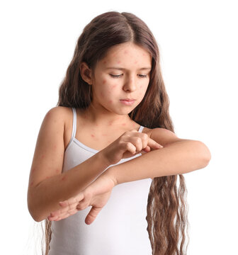 Waterpox Bilder – Durchsuchen 111 Archivfotos, Vektorgrafiken und ...