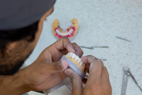 Prosthodontics Images – Browse 8,645 Stock Photos, Vectors, and Video ...