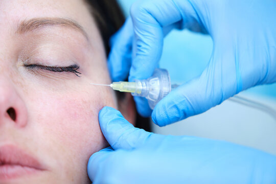 Carboxytherapy Images – Browse 681 Stock Photos, Vectors, and Video ...