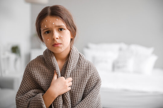 Waterpox Bilder – Durchsuchen 111 Archivfotos, Vektorgrafiken und ...