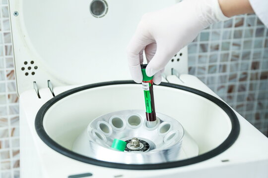 รูปภาพVacutainer – เลือกดูภาพถ่ายสต็อก เวกเตอร์ และวิดีโอ2,156 | Adobe ...