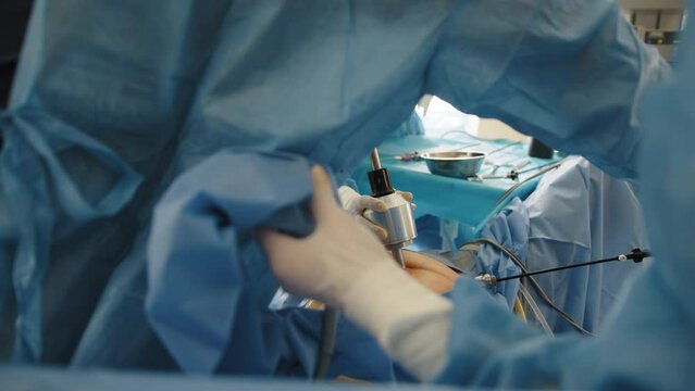 Laparotomy Images – Browse 463 Stock Photos, Vectors, and Video | Adobe ...