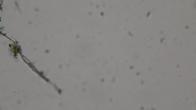 Imágenes de Argulus: descubre bancos de fotos, ilustraciones, vectores ...