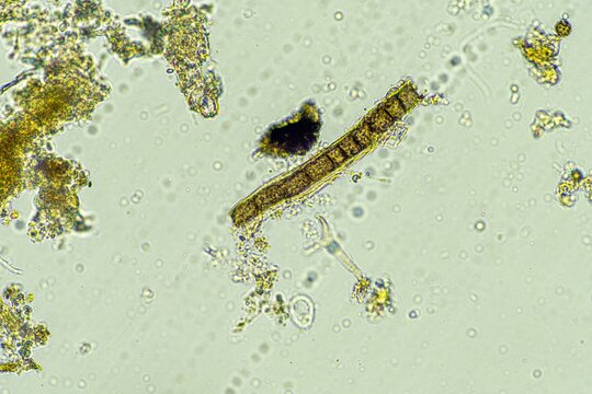 Arthroconidia