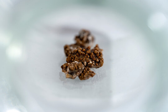 Urinsteine Bilder – Durchsuchen 1,456 Archivfotos, Vektorgrafiken und ...