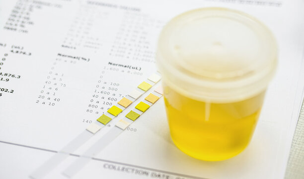 Urine Test Stock Image Urine Test Free Stock Vectors