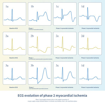 Transmural Images – Browse 19 Stock Photos, Vectors, and Video | Adobe ...