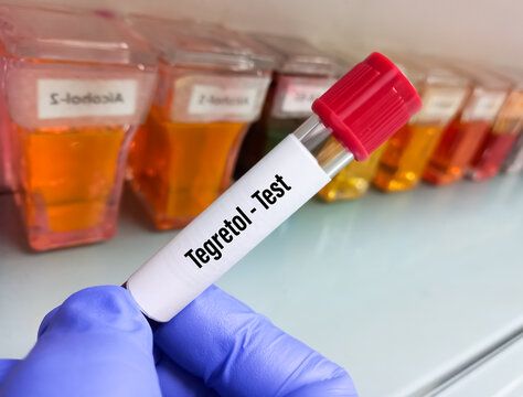 Carbamazepine Imagens – Procure 279 fotos, vetores e vídeos | Adobe Stock