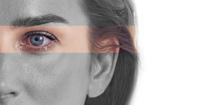 Bindehautsack Bilder – Durchsuchen 1,280 Archivfotos, Vektorgrafiken ...