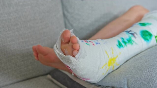 "Itchy Skin" Bilder – Durchsuchen 518 Archivfotos, Vektorgrafiken und ...