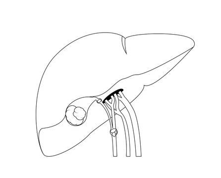 Liver Diagram Unlabeled