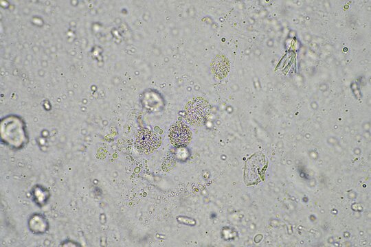 Poop Under Microscope Images – Browse 83 Stock Photos, Vectors, and ...