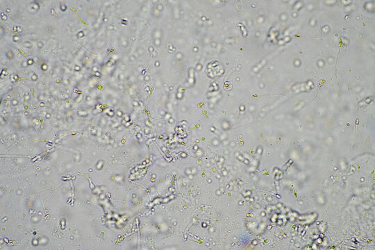 Sperm Count"」の画像 - 107 件の Stock 写真、ベクターおよびビデオ | Adobe Stock