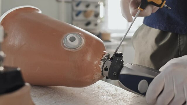 Knee Replacement Parts Images – Browse 203 Stock Photos, Vectors, and ...