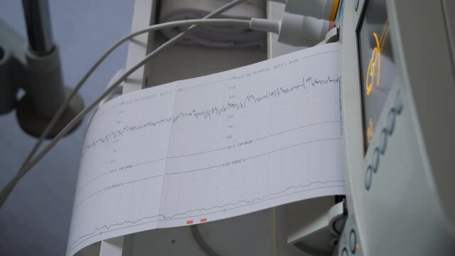 Cardiotocography Images – Browse 814 Stock Photos, Vectors, and Video ...