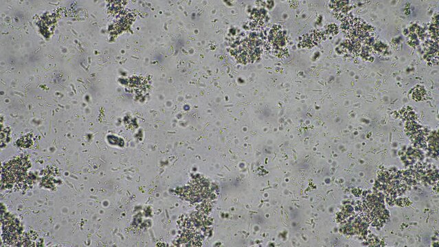 Poop Under Microscope Images – Browse 83 Stock Photos, Vectors, and ...