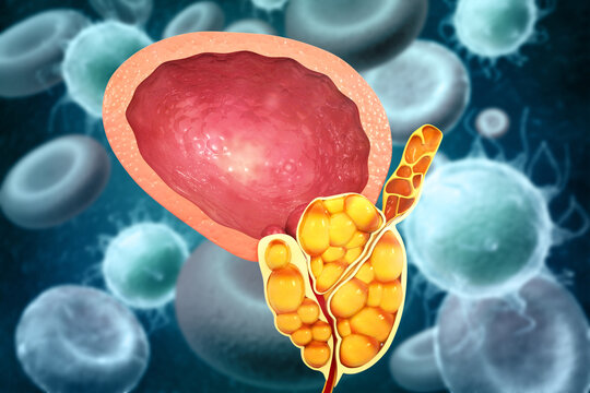 Harnblasenstein Bilder – Durchsuchen 518 Archivfotos, Vektorgrafiken ...