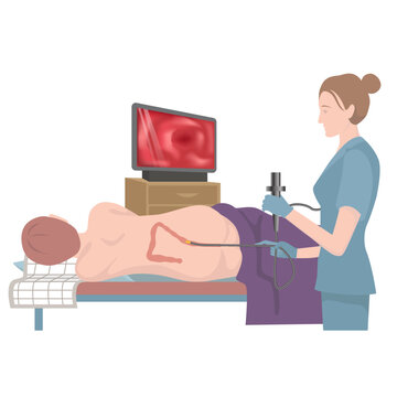"Sigmoid Flexure" Bilder – Durchsuchen 583 Archivfotos, Vektorgrafiken ...