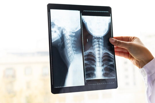 Radiographic Images – Browse 2,935 Stock Photos, Vectors, and Video ...