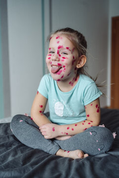 Waterpox Bilder – Durchsuchen 102 Archivfotos, Vektorgrafiken und ...