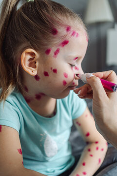 รูปภาพWaterpox – เลือกดูภาพถ่ายสต็อก เวกเตอร์ และวิดีโอ111 | Adobe Stock