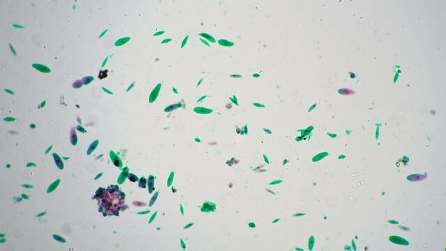 euglena under a compound microscope