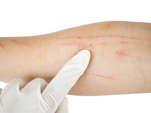 Stray Cat Scratch