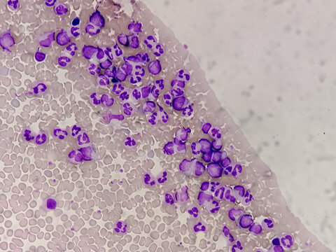 รูปภาพLymphoblast – เลือกดูภาพถ่ายสต็อก เวกเตอร์ และวิดีโอ312 | Adobe Stock