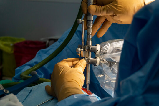 Craniotomy Imagens – Procure 334 fotos, vetores e vídeos | Adobe Stock