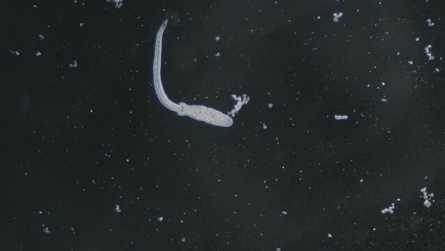 รูปภาพTrematodes – เลือกดูภาพถ่ายสต็อก เวกเตอร์ และวิดีโอ886 | Adobe Stock