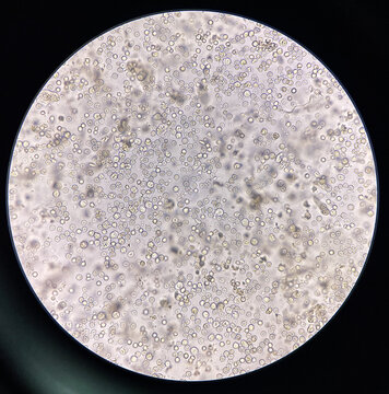 รูปภาพWbc – เลือกดูภาพถ่ายสต็อก เวกเตอร์ และวิดีโอ14,514 | Adobe Stock