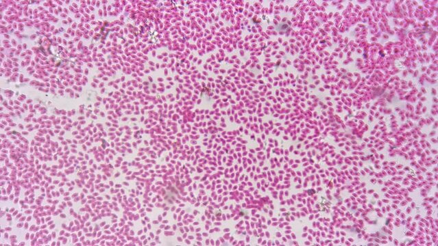 Blood Tissue Under Microscope